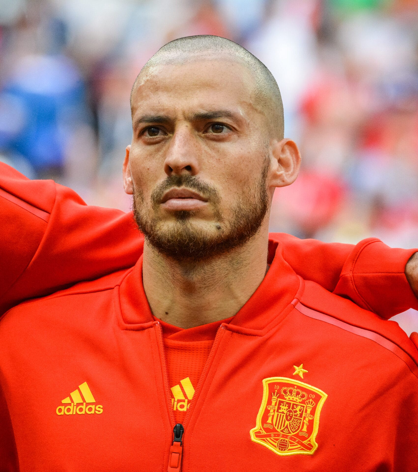 David Silva Hair Transplant: Before, After and His New Hairline