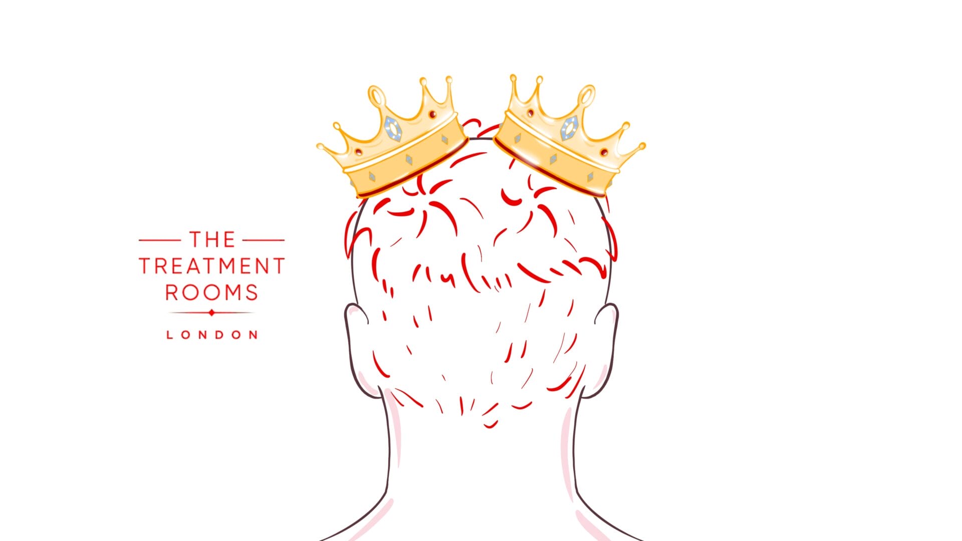 Hair Transplant Clinic UK | Book With Treatment Rooms London