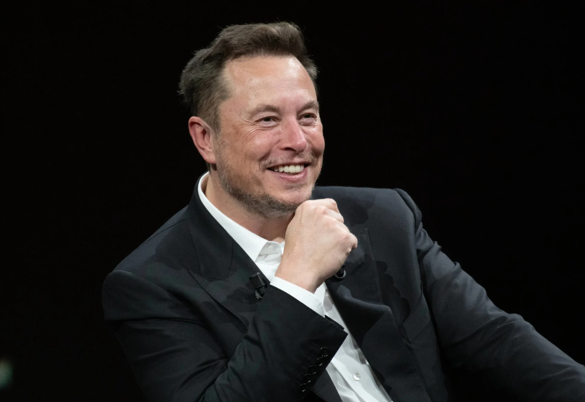 Elon Musk Hair Transplant: Before, After and His New Hairline