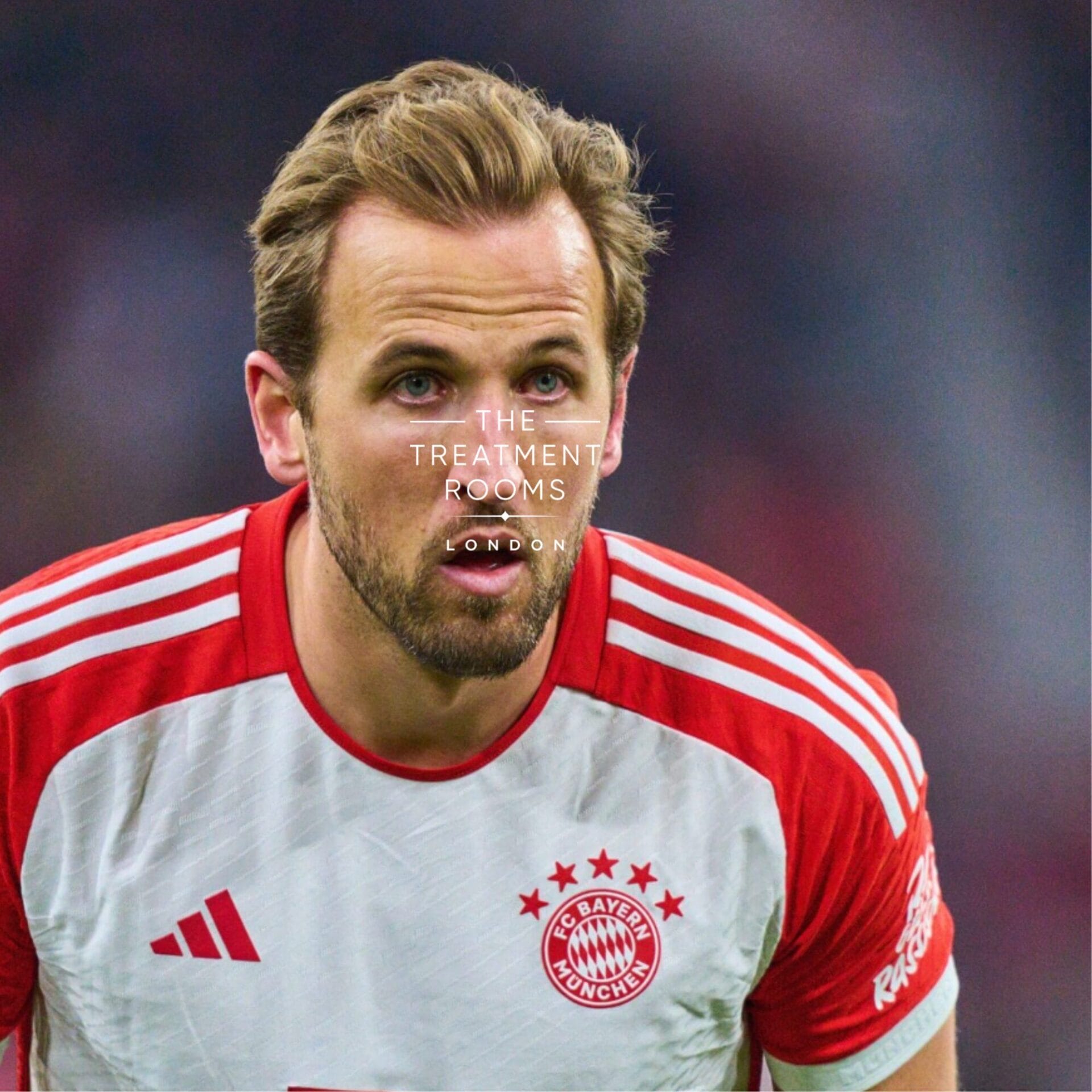 Harry Kane's Hair and Hairline: All You Need to Know