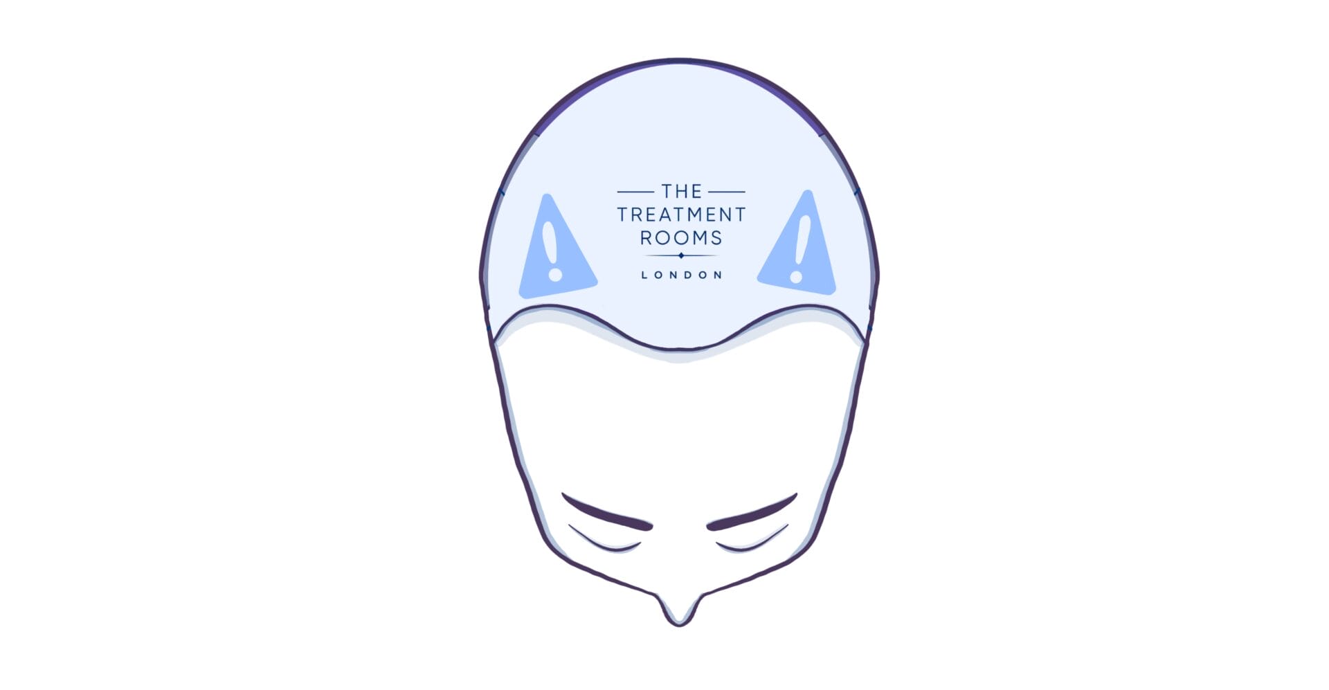 Temporal Alopecia Guide | Treatment Rooms London