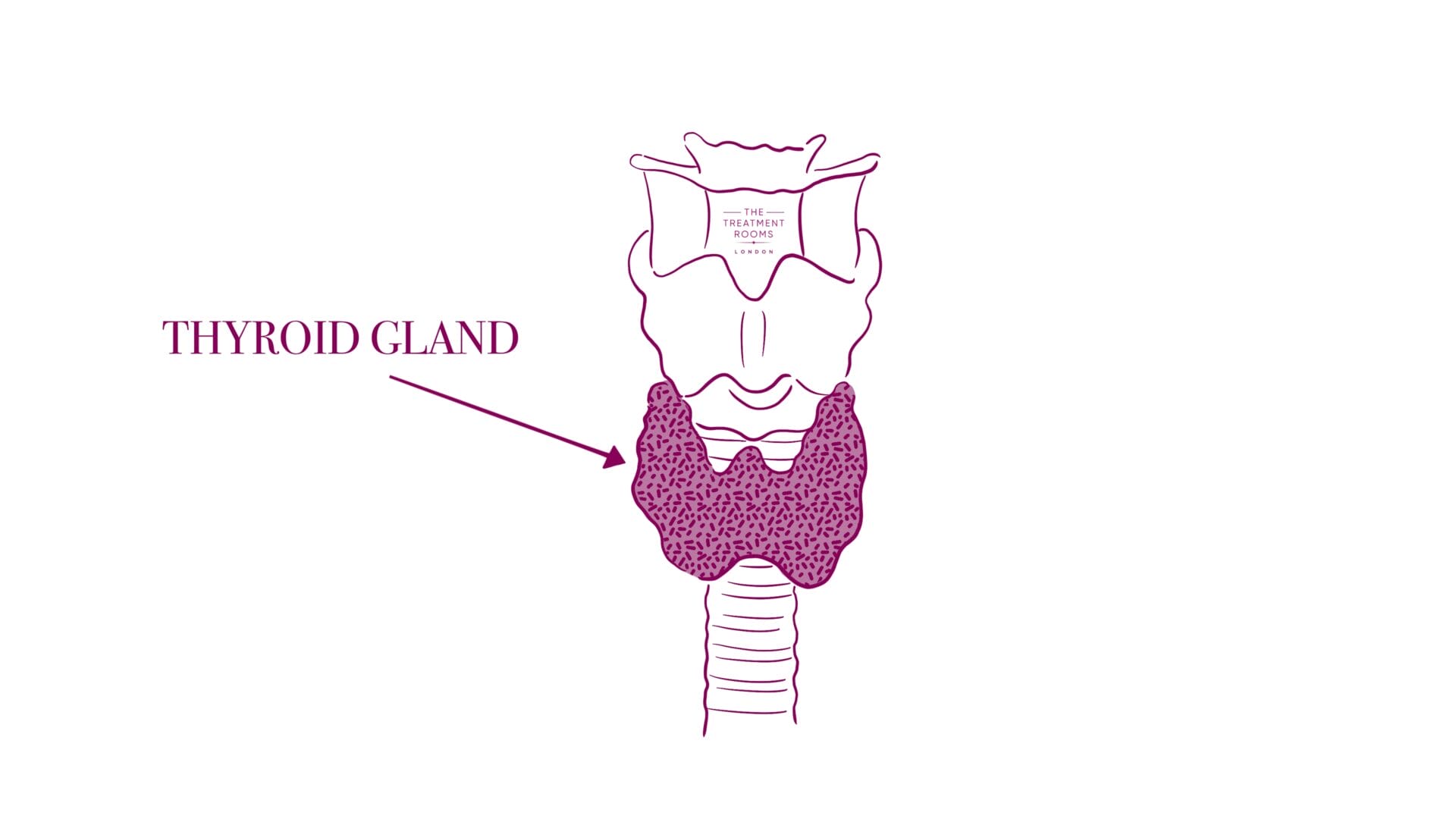 Thyroid And Female Hair Loss Treatment Rooms London