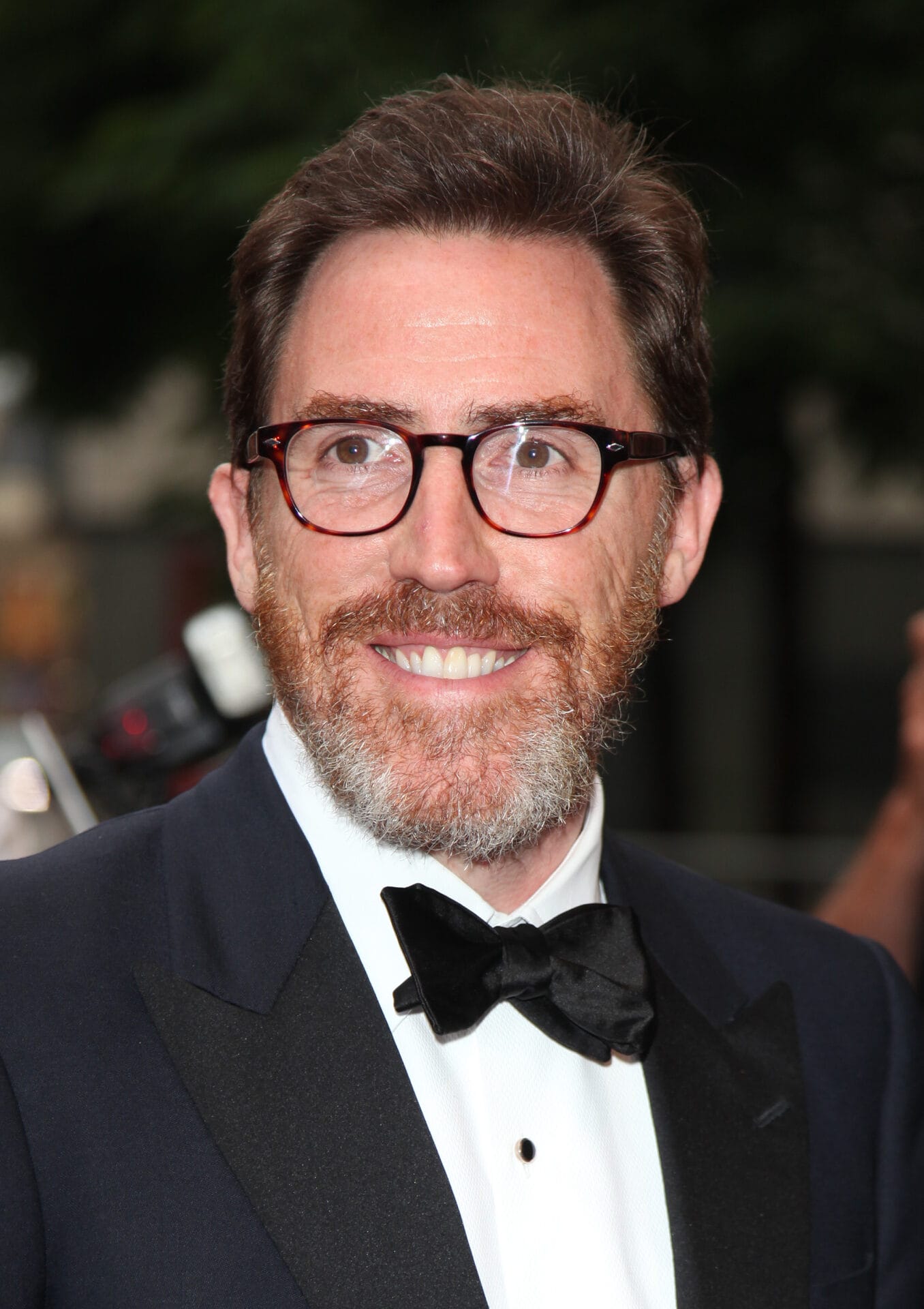 Rob Brydon Hair Transplant: Before & After & Our Expert View
